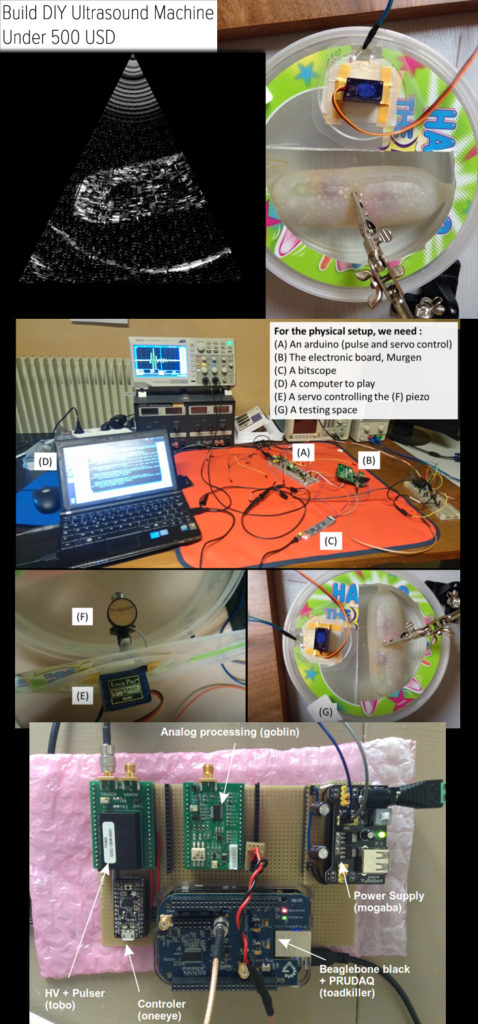 Build DIY Ultrasound Machine Under 500 USD